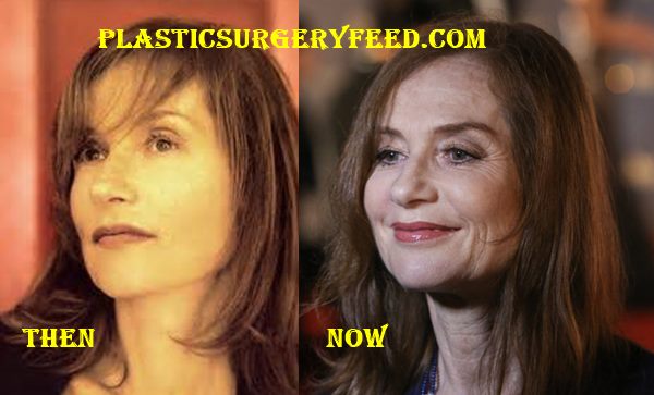 Isabelle Huppert Plastic Surgery - Plastic Surgery Feed Isabelle Huppert Plastic Surgery - Plastic Surgery Feed