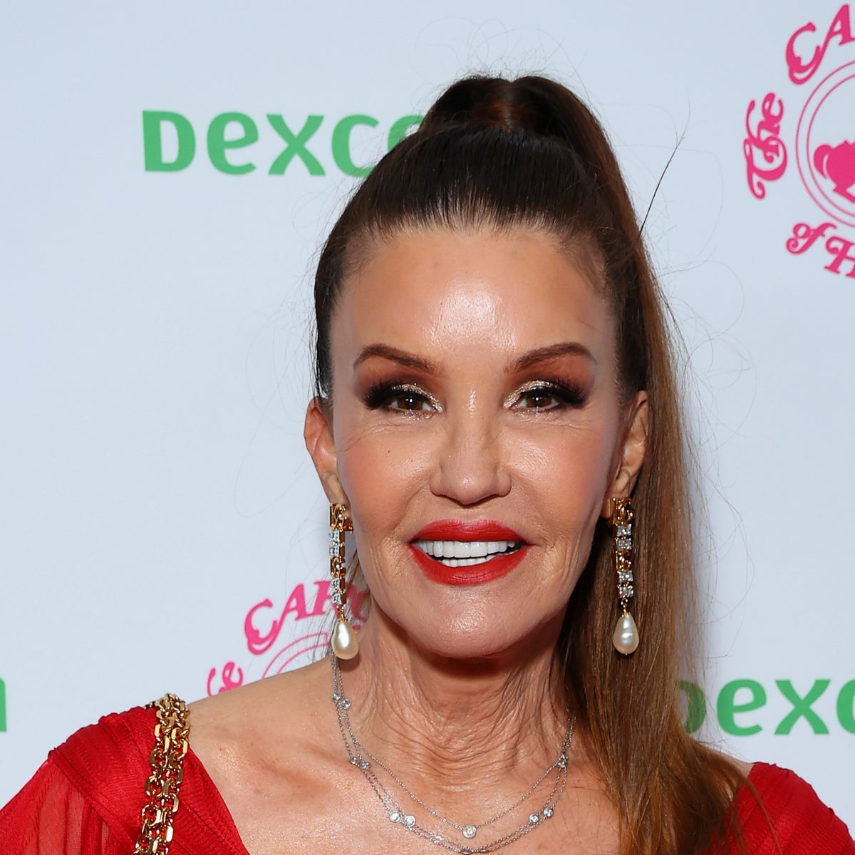 Janice Dickinsons Plastic Surgery What We Know So Far Plastic Surgery Feed